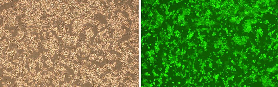 Herpes Simplex Virus (HSV) Cloning and Packaging | VectorBuilder